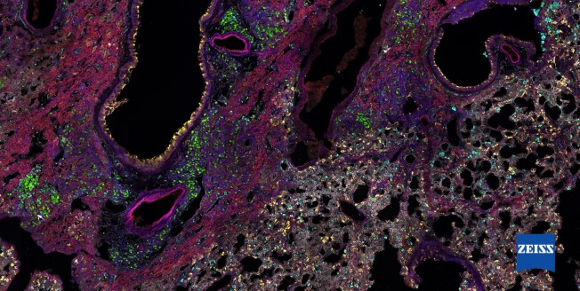 The Analytical Scientist | Case Study: Spatial Biology Studies in Lung ...